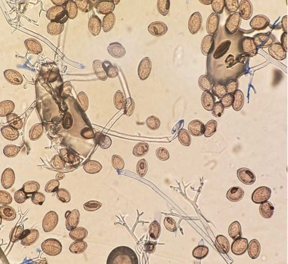 First cucurbit downy mildew spores identified in air samples in Allegan ...